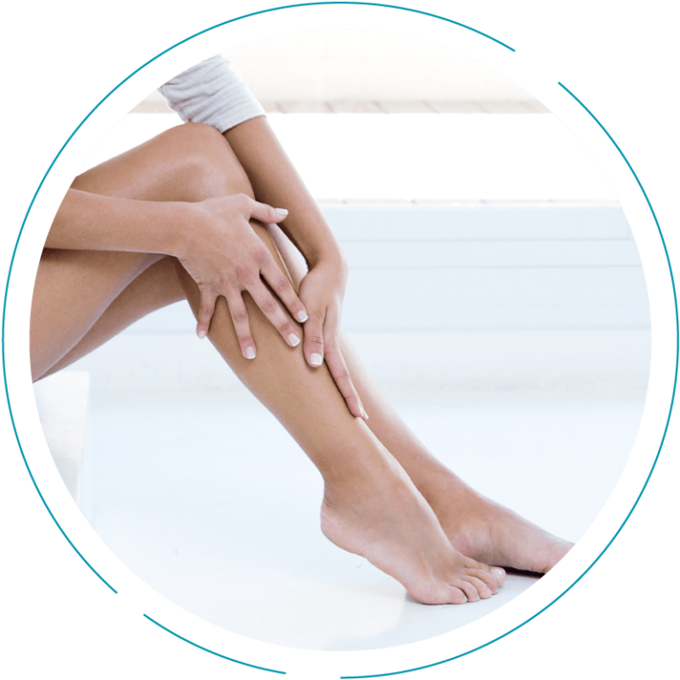 Tratamientos para Varices en Málaga - Clínica Dra. Caparrós